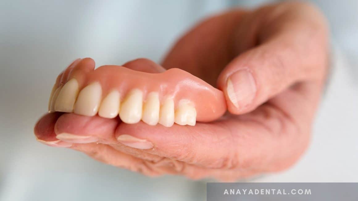 Tooth Decay Under Bridge- Causes and Symptoms – Anaya Dental