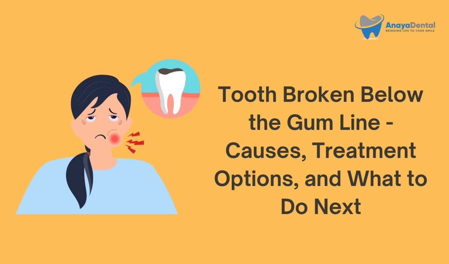 Tooth Broken Below the Gum Line: Causes, Treatment Options, and What to ...