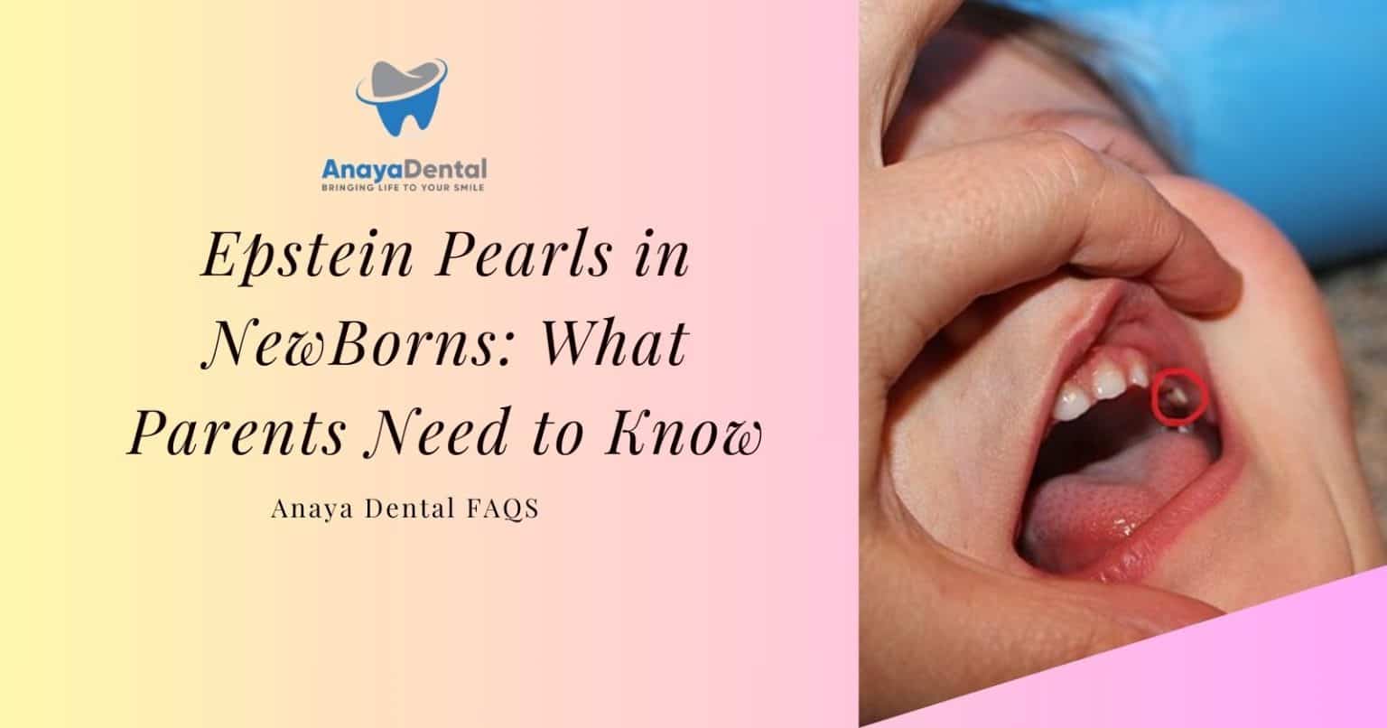 Epstein Pearls in Newborns: What Parents Need To Know - Anaya Dental