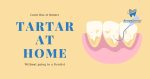 How to Remove Tartar from Teeth at Home: Essential Dental Care Tips