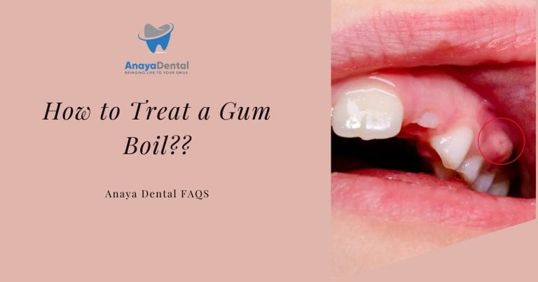 What is Gum Boil: Causes, Symptoms, and Treatment Options