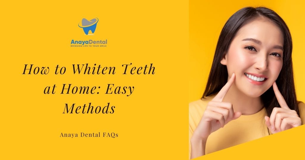 How to Whiten Teeth at Home - Anaya Dental