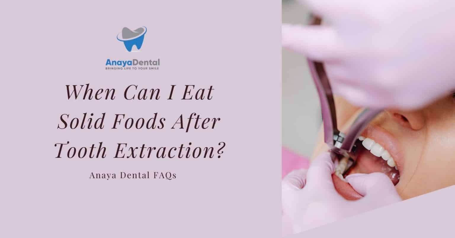 When Can I Eat Solid Foods After Tooth Extraction? - Anaya Dental