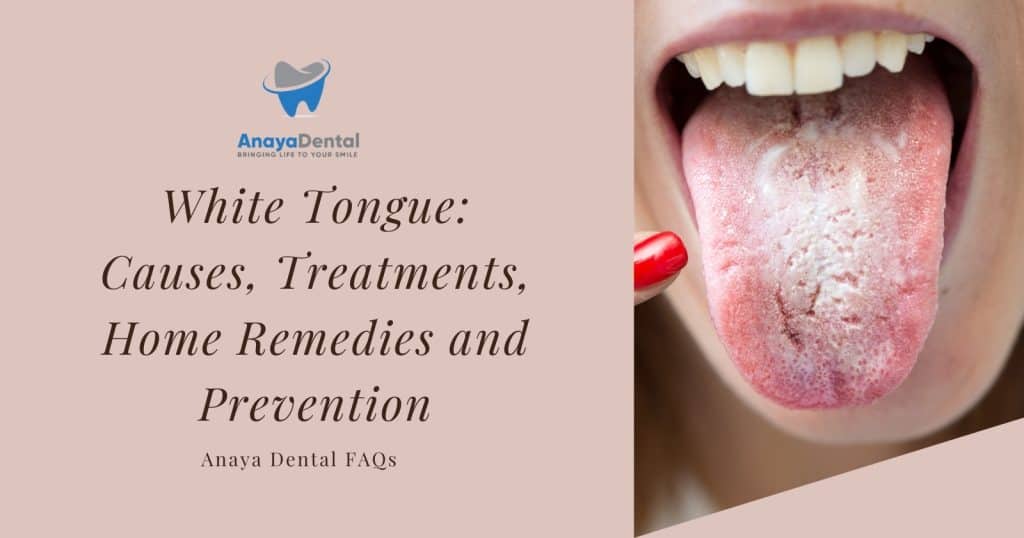 White Tongue: Causes, Treatments, and Prevention - Anaya Dental
