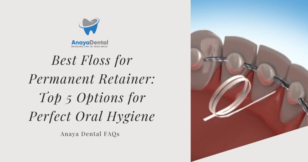 Best Floss for Permanent Retainer: Top 5 Options for Perfect Oral ...