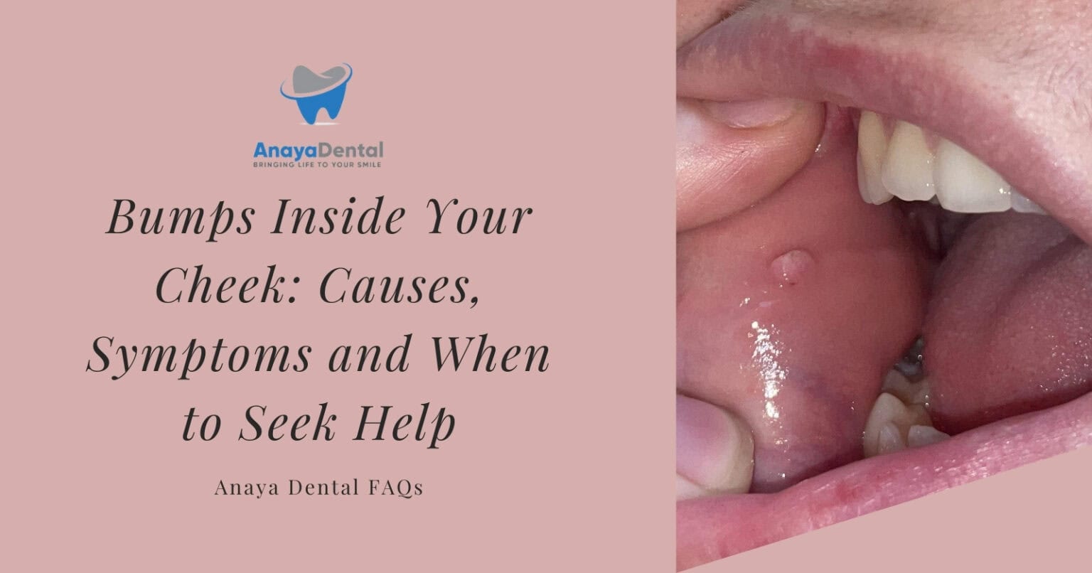Bumps Inside Your Cheek: Causes, Symptoms and When to Seek Help - Anaya ...