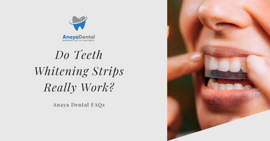 Do Teeth Whitening Strips Really Work? The Complete Guide - Anaya Dental