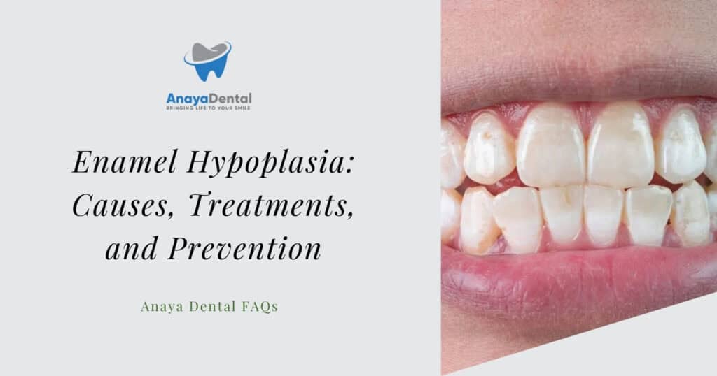 Enamel Hypoplasia: Causes, Treatments, and Prevention - Anaya Dental