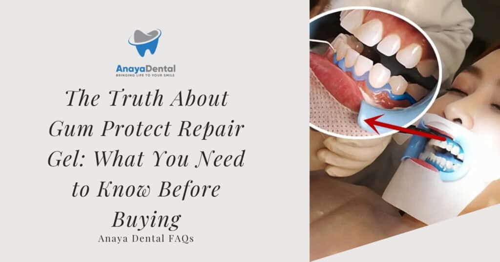 The Truth About Gum Protect Repair Gel: What You Need to Know Before ...