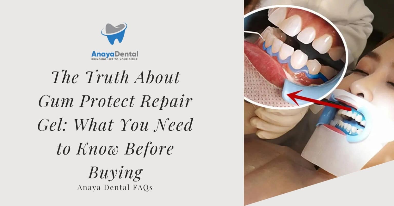 The Truth About Gum Protect Repair Gel: What You Need to Know Before ...
