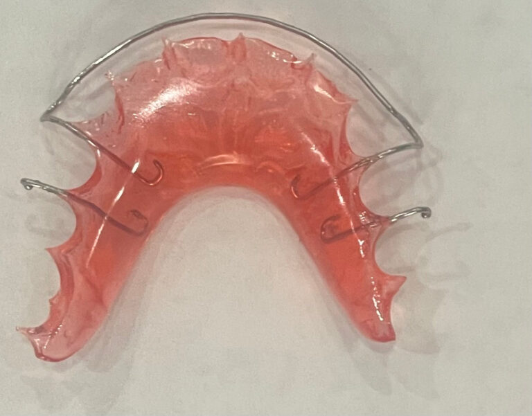 Best Retainer Cleaner Brands to Try in 2025 - Anaya Dental