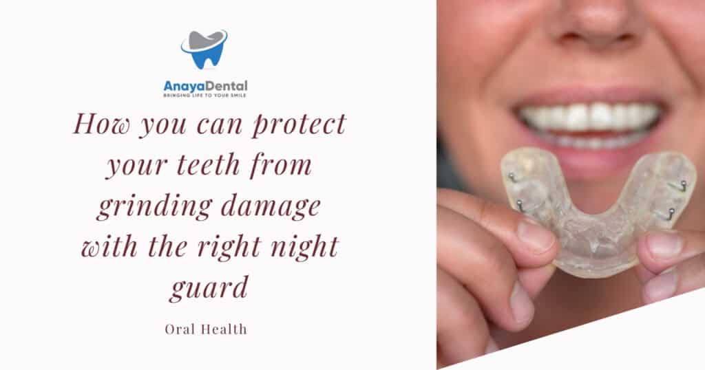 Best Night Guards for Teeth Grinding - Anaya Dental