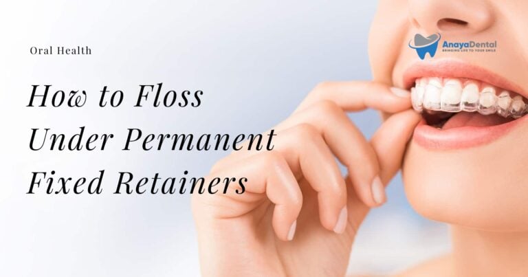 How to Floss Under Permanent Fixed Retainers - Anaya Dental