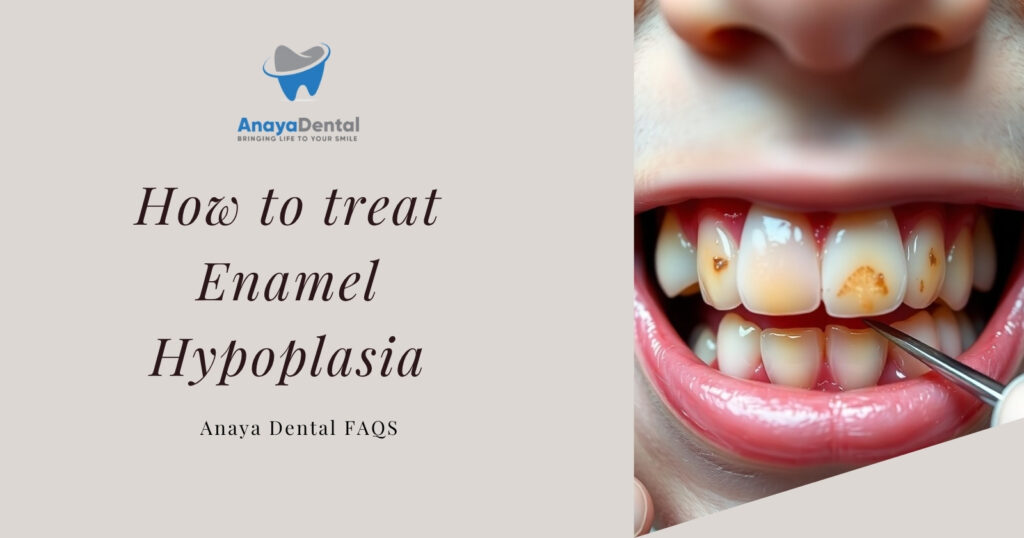 How to treat Enamel Hypoplasia - Anaya Dental
